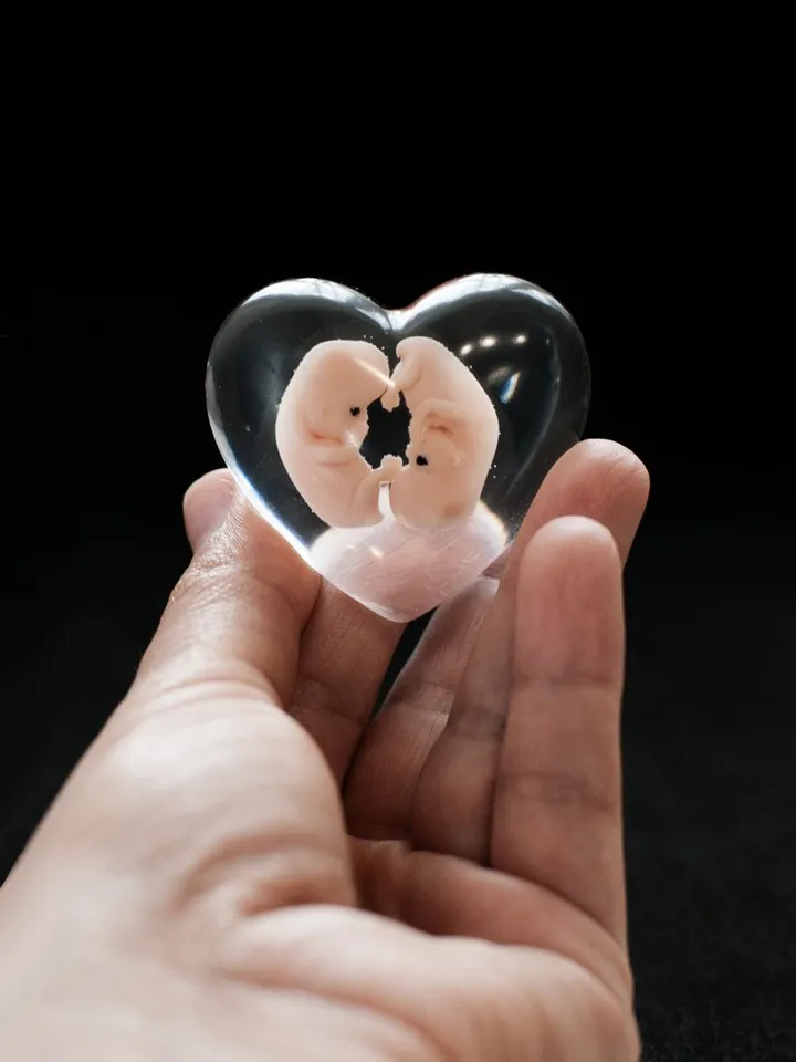 Twins Embryo 8 weeks cast in resin, 8 weeks pregnant, bereavement fetus ...