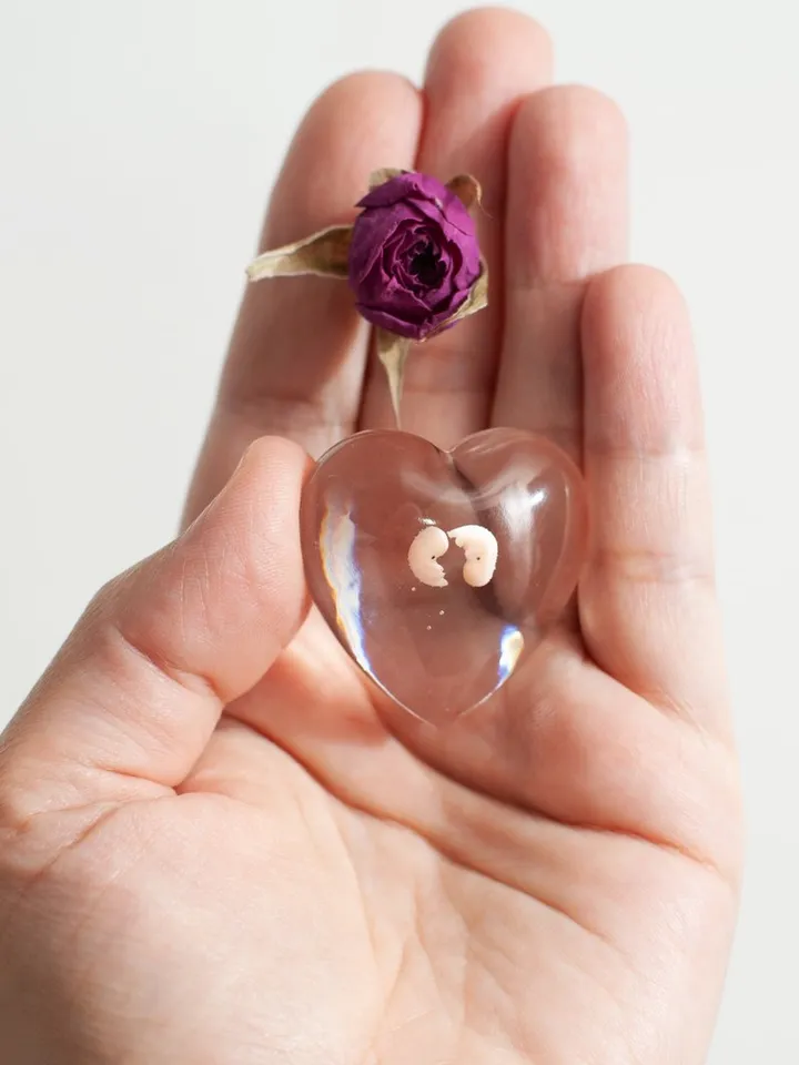 Twins Embryo 5-6 weeks, 5 weeks pregnant, Sculpture cast in resin $35. ...