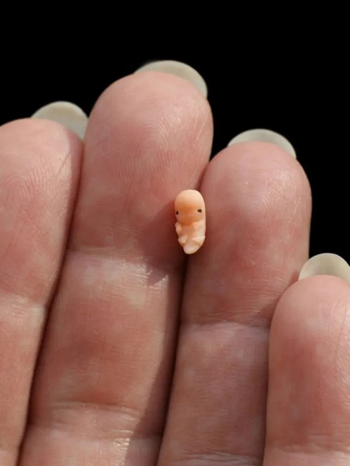Embryo 5-6 weeks, 5 weeks pregnant, bereavement fetus $10.00 | Buy ...