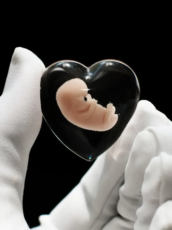 Embryo 8 weeks, 8 weeks pregnant, Sculpture cast in resin $45.00 | Buy ...