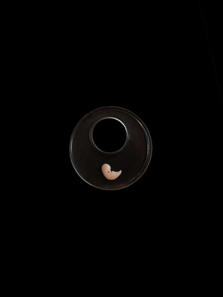 Embryo 5-6 weeks, 5 weeks pregnant, pendant, bereavement fetus, cast in ...