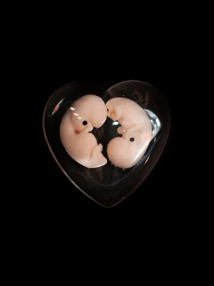 Twins Embryo 7 weeks, 7 weeks pregnant, bereavement fetus $50.00 | Buy ...